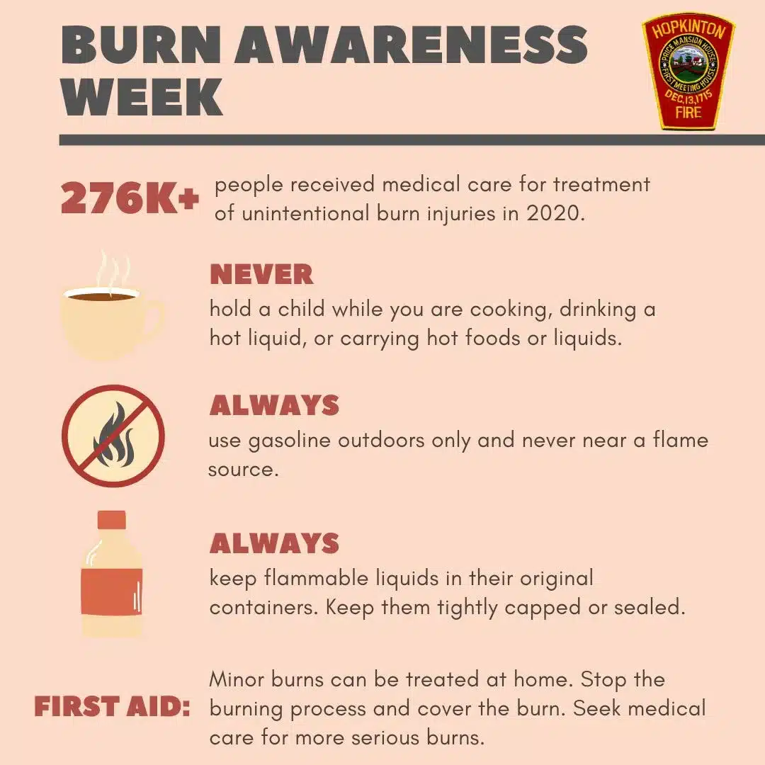 Hopkinton Fire Department Shares Burn Injury Prevention Tips During ...